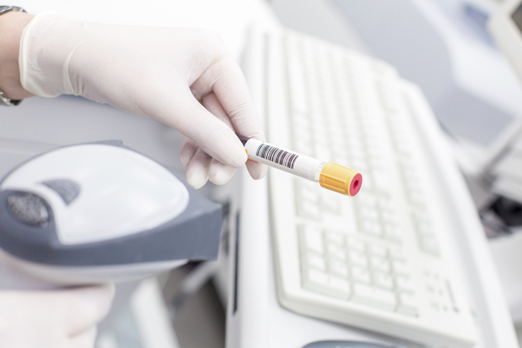 Zespół Gilberta (hiperbilirubinemia) - co to za choroba? Objawy ...